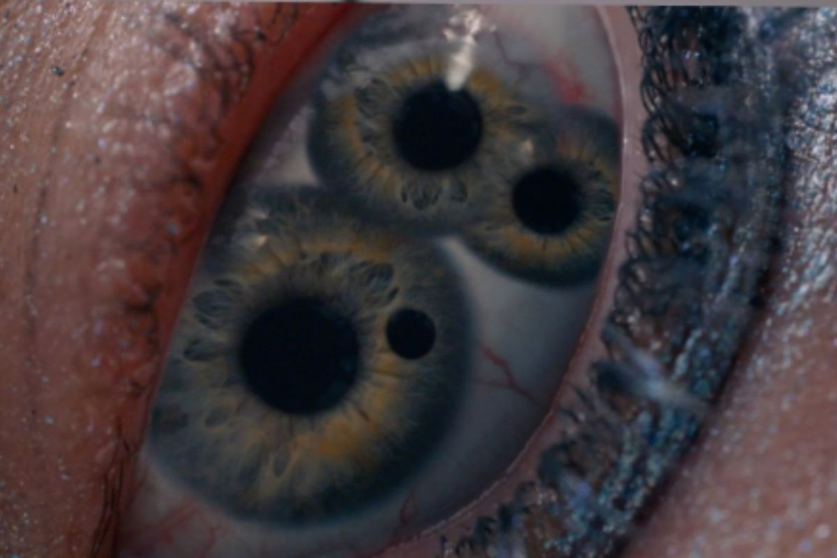 "A Substância" chegará ao streaming; saiba quando